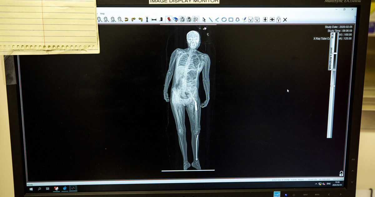 A giant X-ray now lets Denver's coroner provide more culturally ...